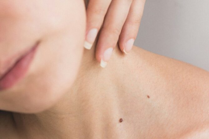How To Patch Test Skincare 2025 All About The Gloss