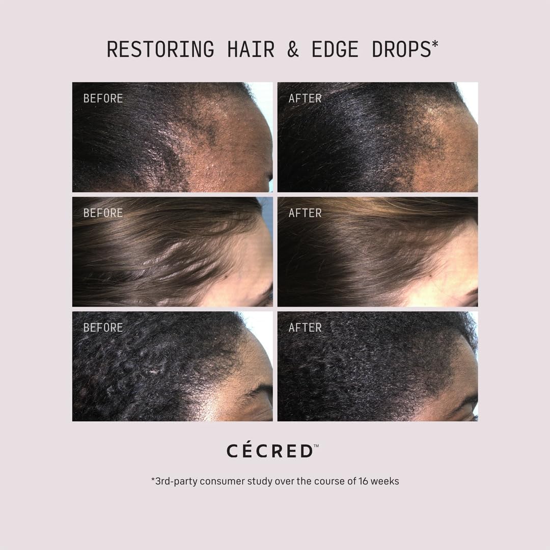 Cécred Hair Drops Review: Transform Your Edges and Restore Scalp Health ...
